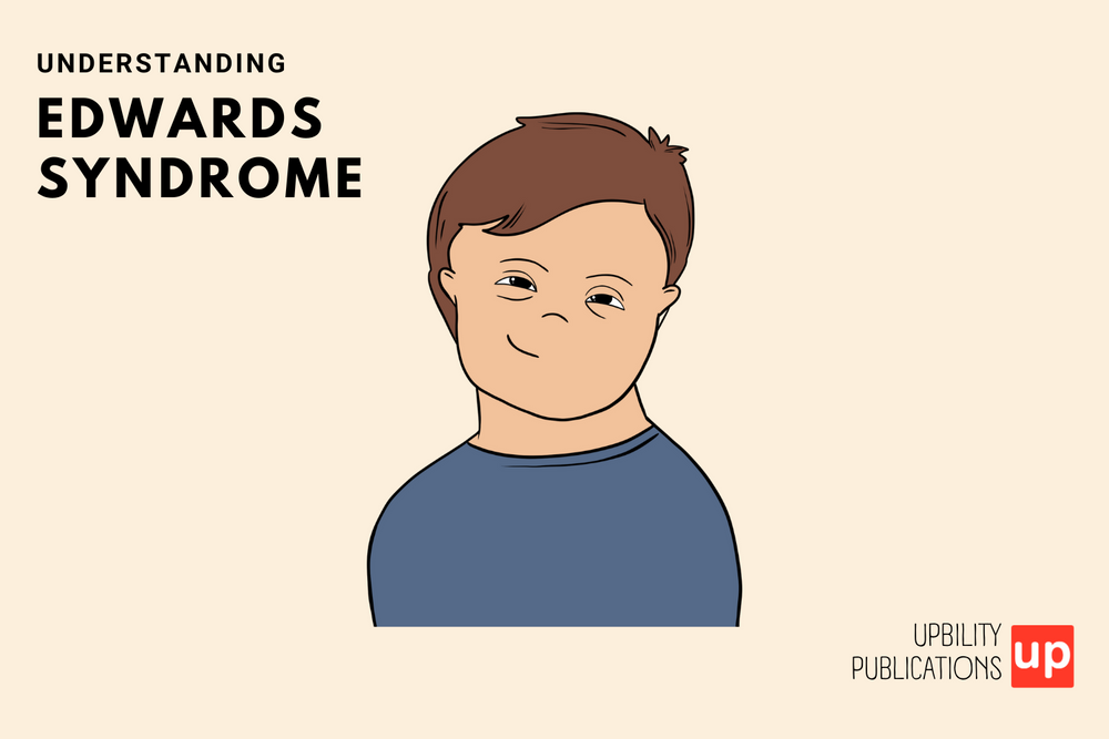 Understanding Edwards Syndrome – Upbility Publications